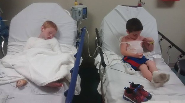 Go Ask Mum Two Boys Suffer Second and Third Degree Burns While in ...