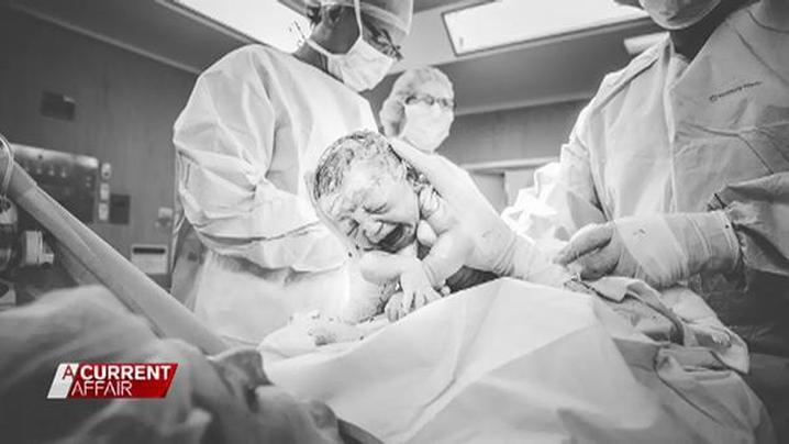 Go Ask Mum Queensland Mum Delivers Own Baby Via Caesarean Section - Go ...