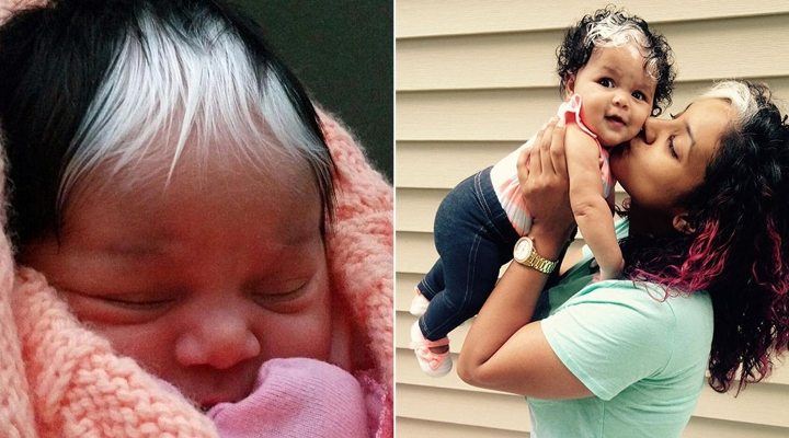 Go Ask Mum An Adorable Baby Born With a Tuft of White Hair Carries ...