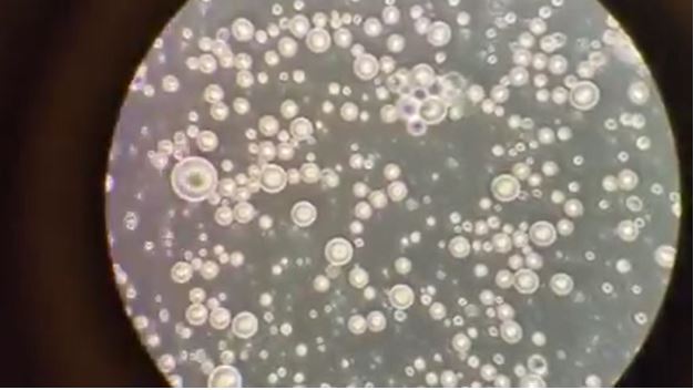 Go Ask Mum People Can't Stop Sharing This Video of Breastmilk Under a ...