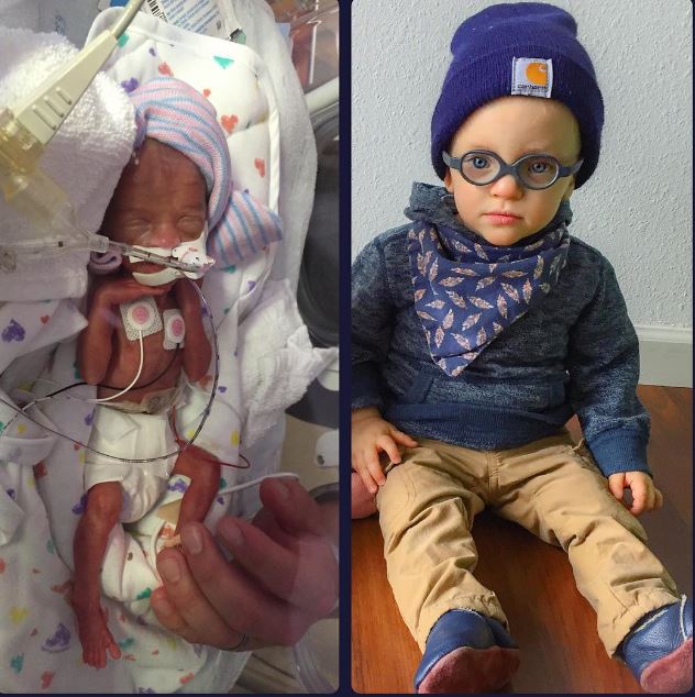 Go Ask Mum Preemie Parents Share Their NICU Photos to Offer Hope - Go ...